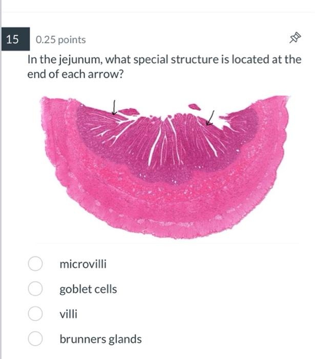 Solved 0.25 points In the jejunum, what special structure is | Chegg.com
