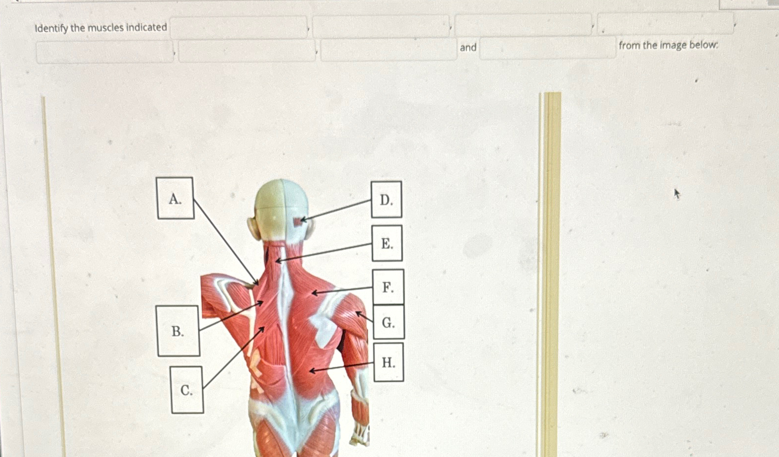 Solved Identify the muscles indicated | Chegg.com