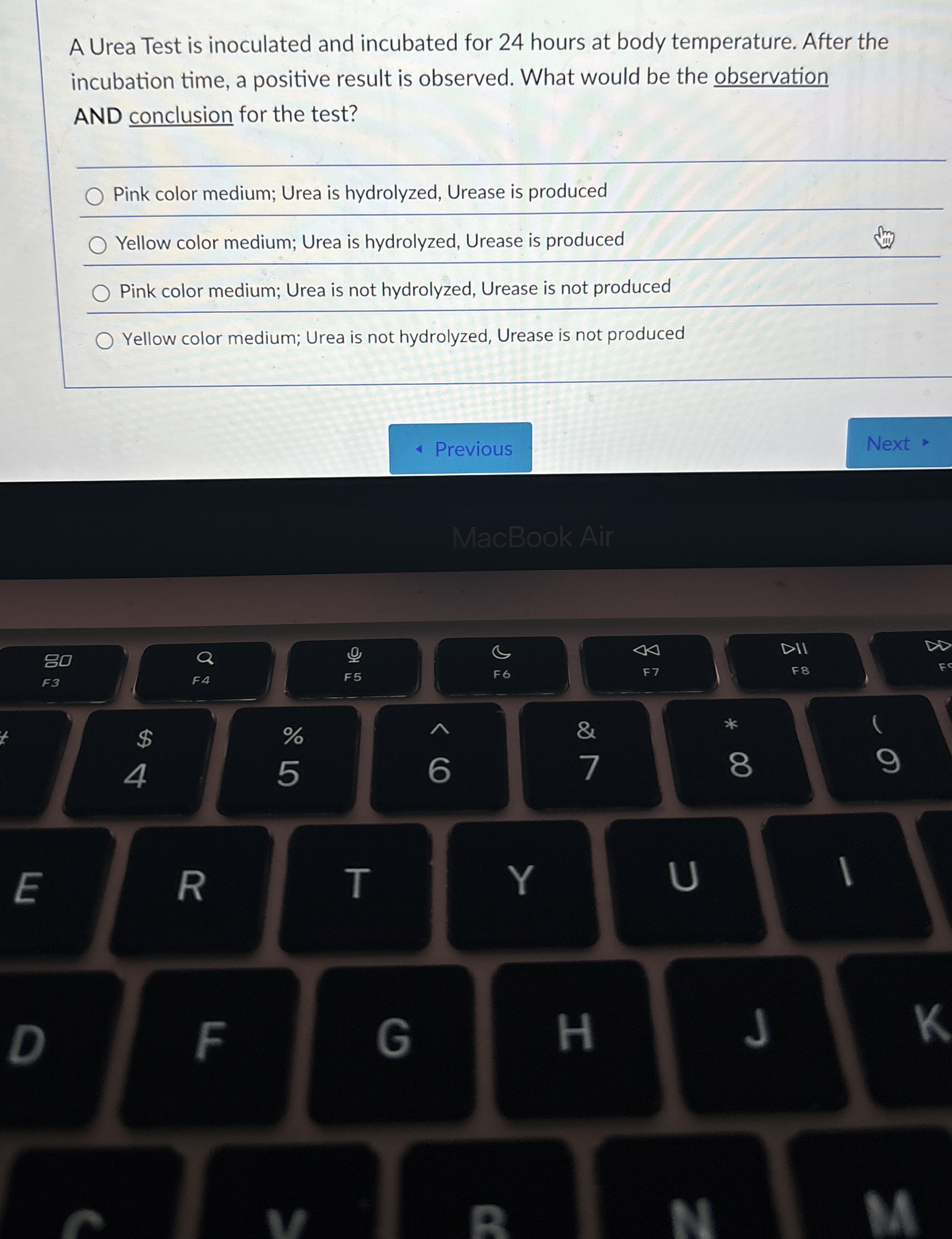 Solved A Urea Test is inoculated and incubated for 24 ﻿hours | Chegg.com