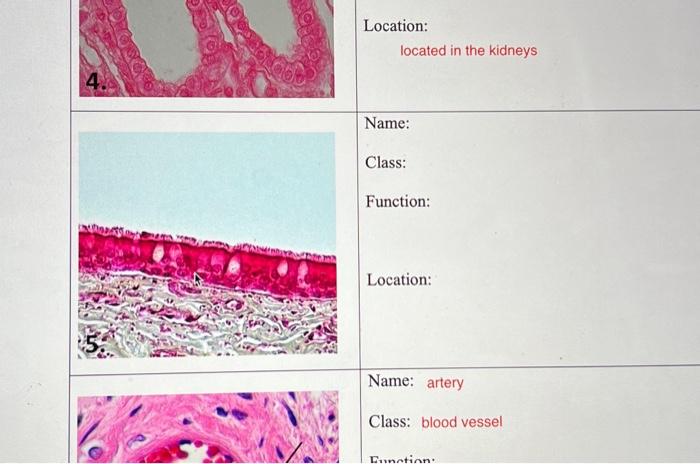 Solved Location: located in the kidneys Name: Class: | Chegg.com