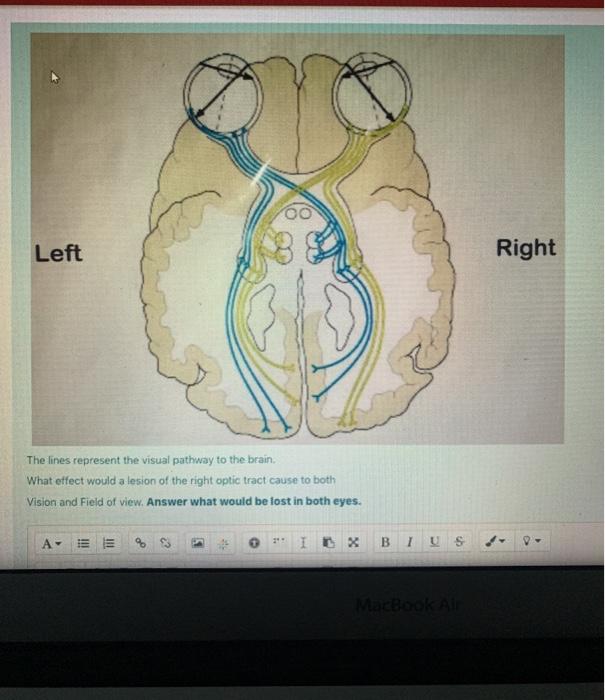Solved co Left Right The lines represent the visual pathway | Chegg.com