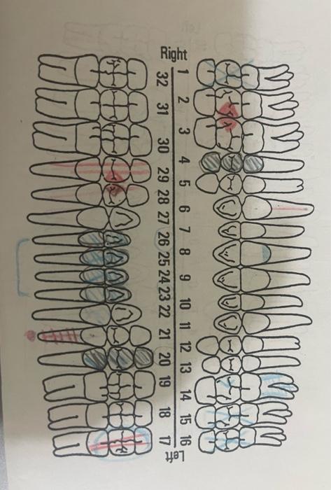 Solved CHARTING EXERCISE \#I DO NOT WRITE IN THIS BOOKLET | Chegg.com