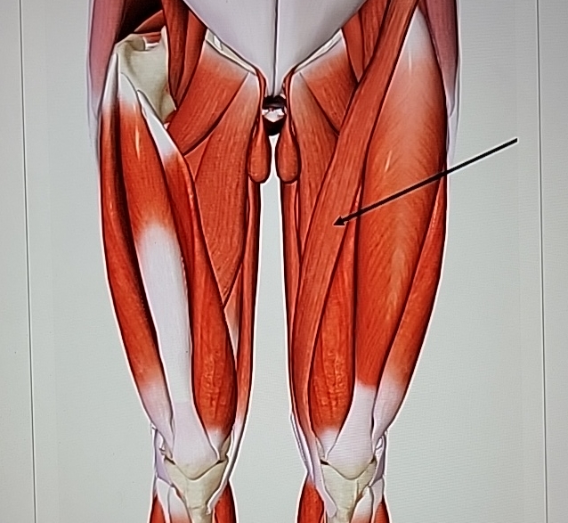 Solved name the muscle the arrow is pointing at | Chegg.com