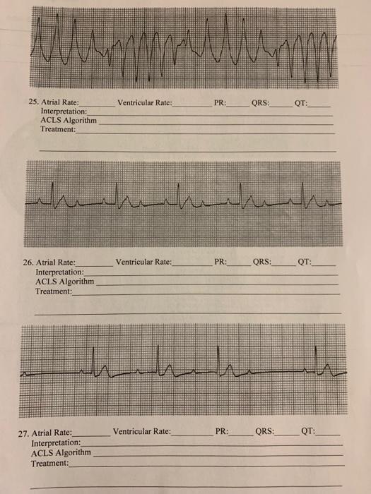 Solved Ventricular Rate: PR: QRS: QT: 25. Atrial Rate: | Chegg.com