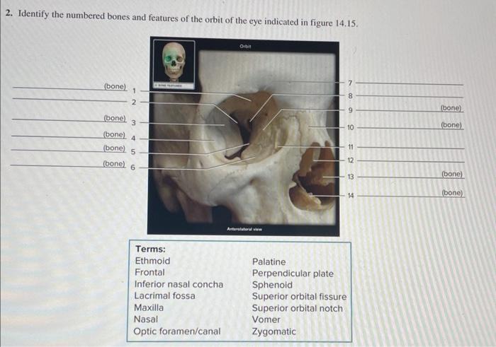 Solved 2. Identify the numbered bones and features of the | Chegg.com
