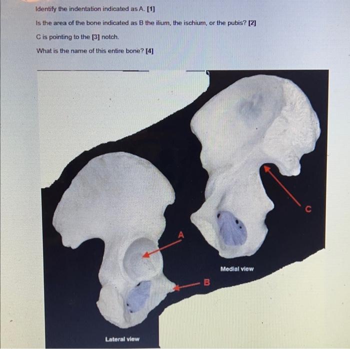 Solved Identify the indentation indicated as A. [1] Is the | Chegg.com