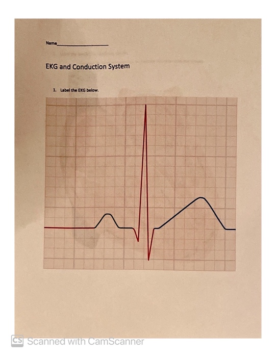 Solved 2. Label the major blood vessels. 2 CS Scanned with | Chegg.com