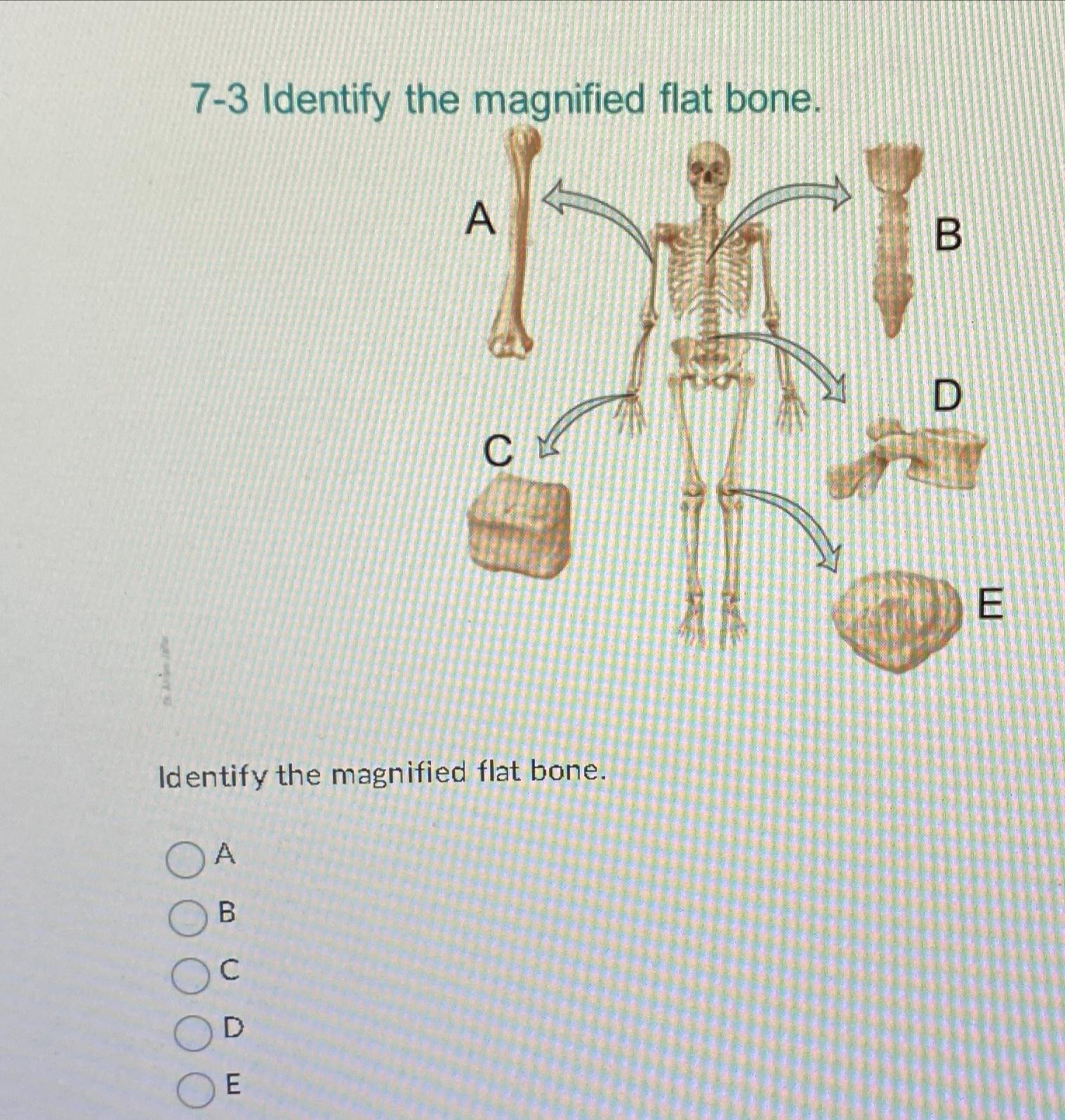 Solved 7-3 ﻿Identify the magnified flat bone.Identify the | Chegg.com
