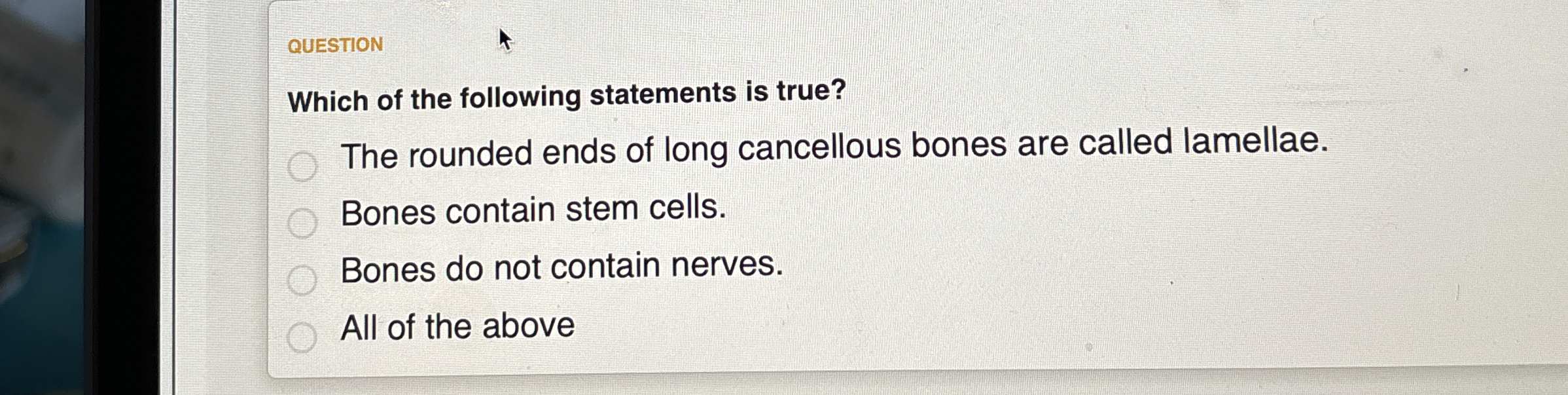Solved QUESTIONWhich of the following statements is true?The | Chegg.com