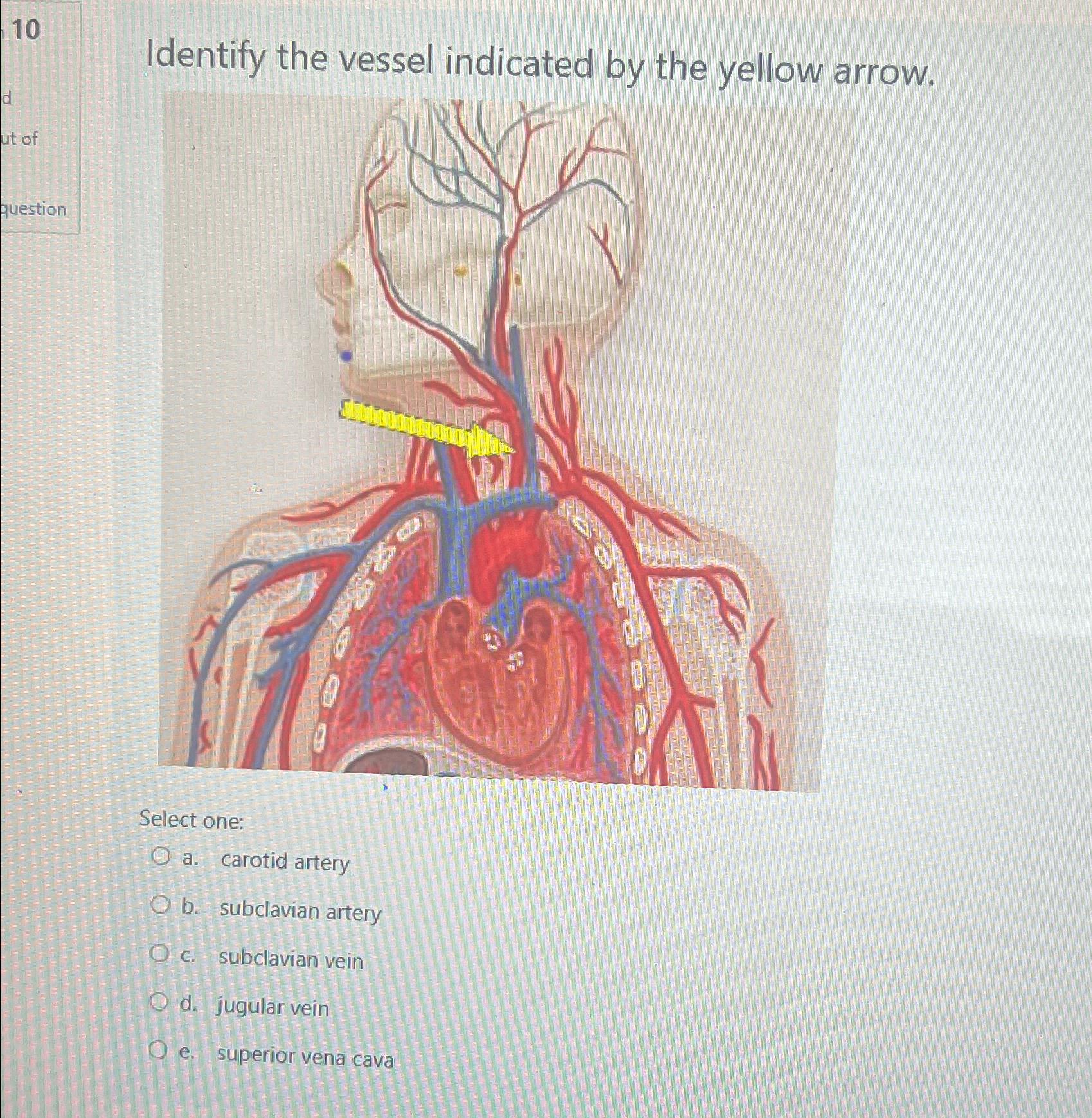 10Identify the vessel indicated by the yellow | Chegg.com