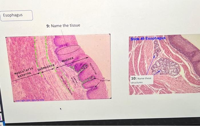 Solved Name the layers of the small intes Higher | Chegg.com