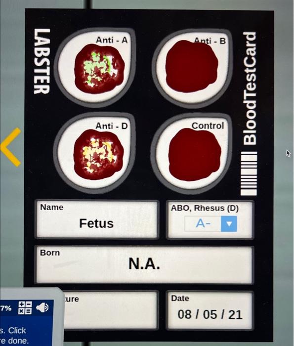 Solved Zoom into the individual Eldon card, and select the | Chegg.com