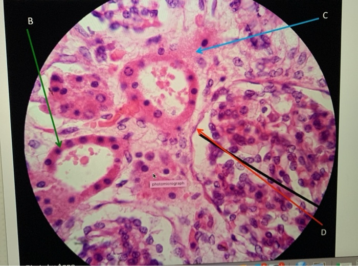 Solved a) Looking at the entire photomicrograph, what is the | Chegg.com