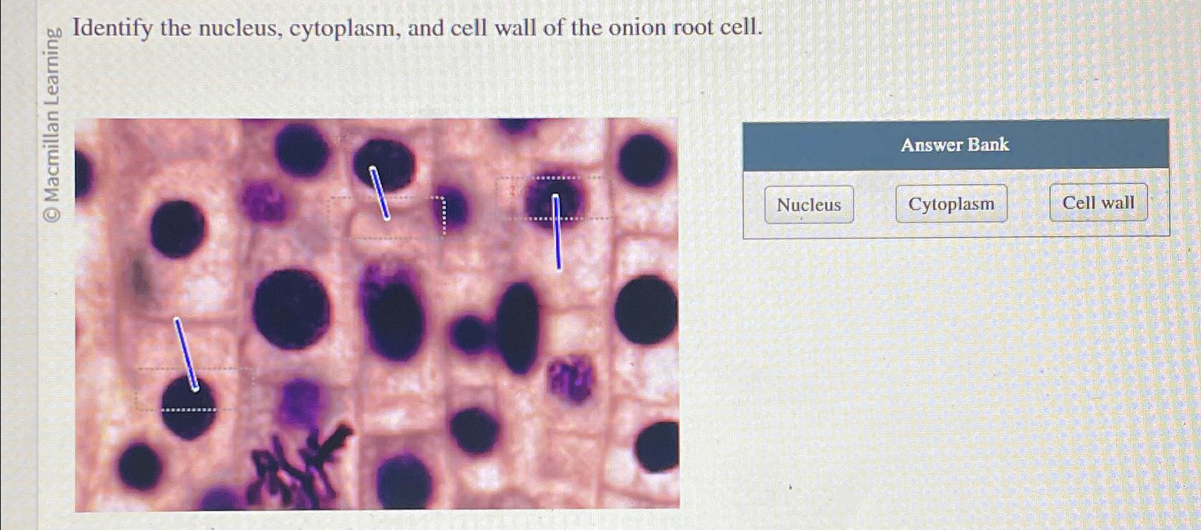 Solved on Identify the nucleus, cytoplasm, and cell wall of | Chegg.com
