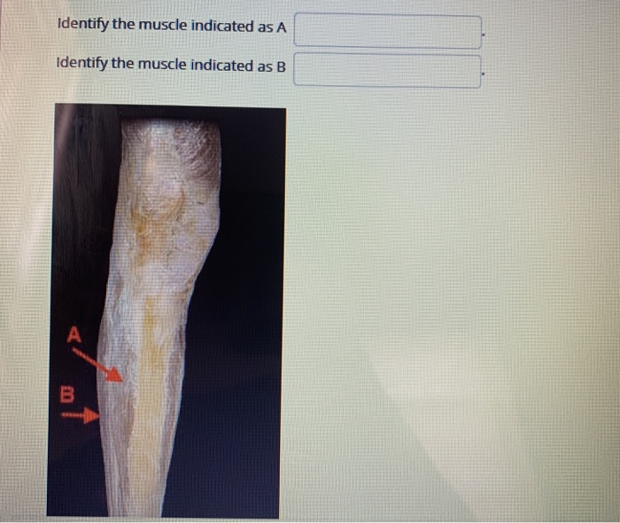 Solved Identify the muscle indicated as A Identify the | Chegg.com