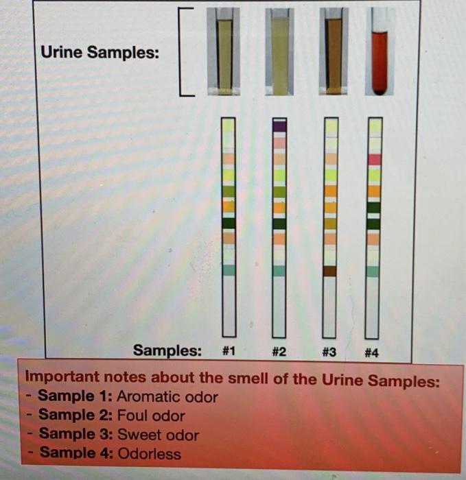 Urinalysis Worksheet Use the urine samples (1-4) and | Chegg.com