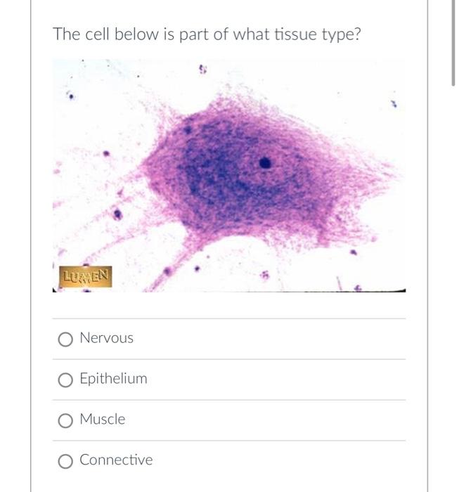 Solved In this Cardiac muscle tissues, what structures are | Chegg.com