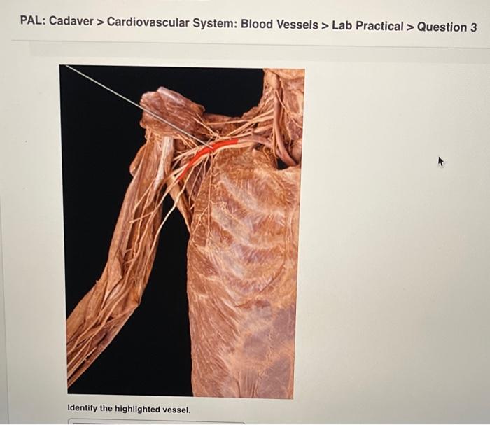 Solved PAL: Cadaver > Cardiovascular System: Blood Vessels > | Chegg.com