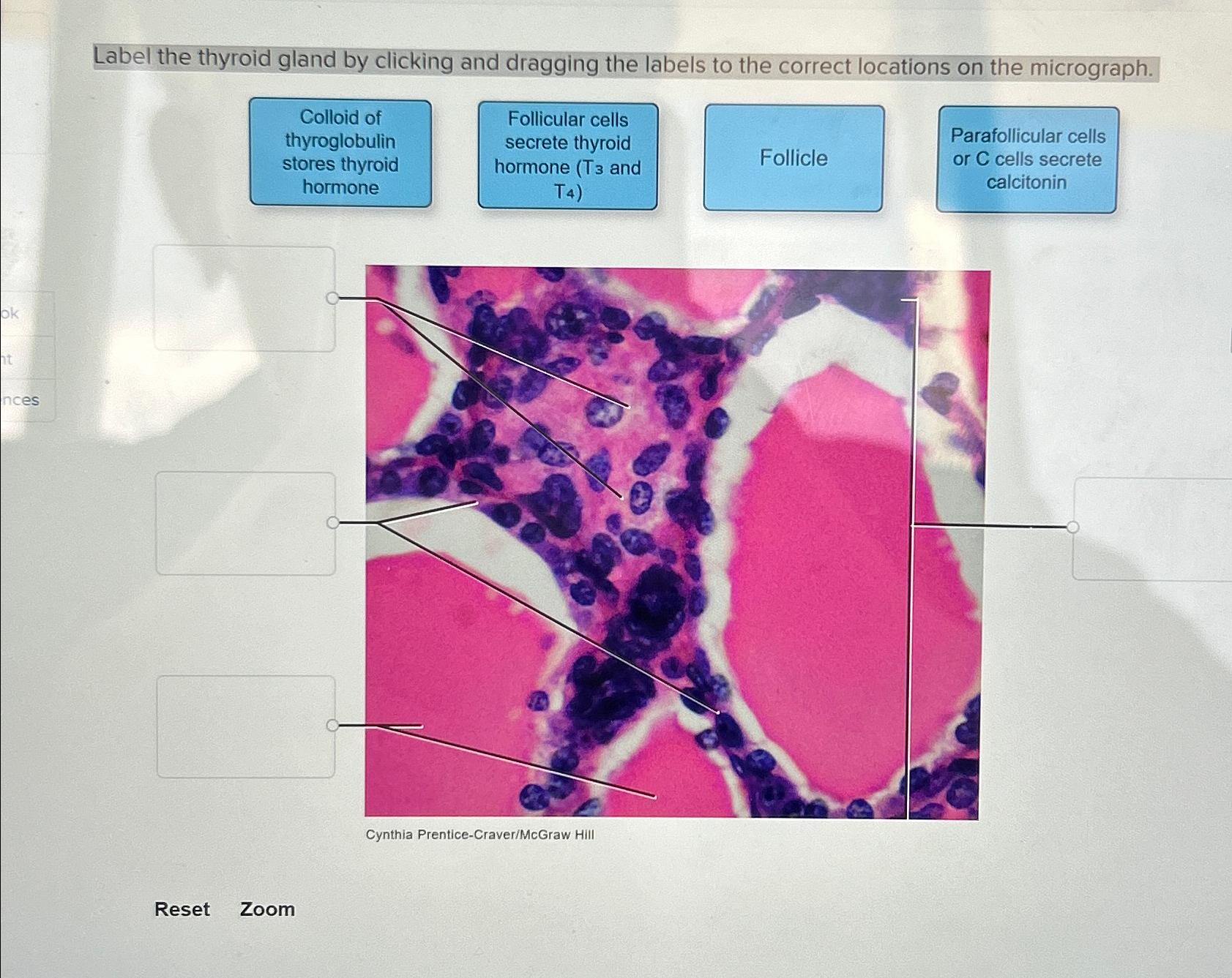 Solved Label the thyroid gland by clicking and dragging the | Chegg.com