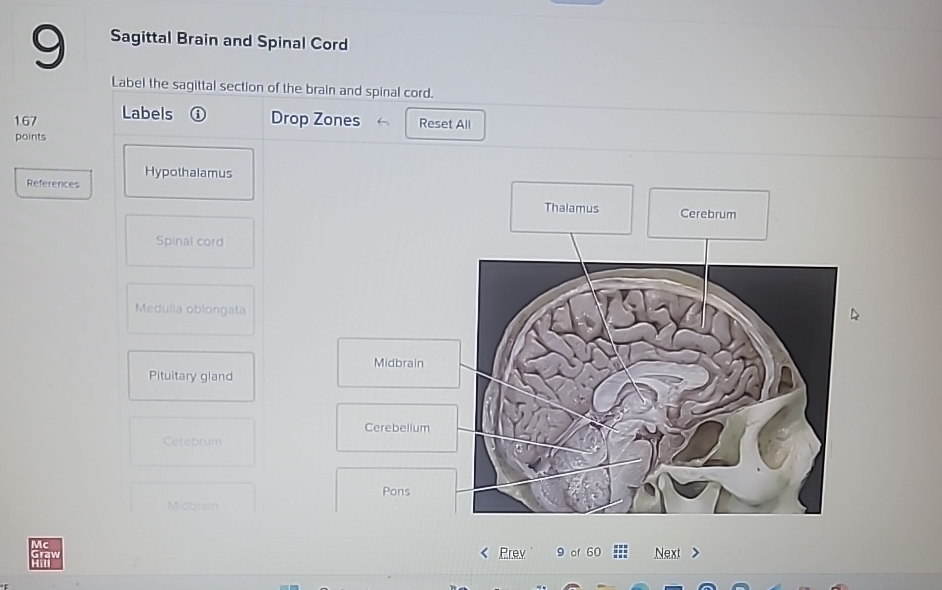 Solved Sagittal Brain and Spinal CordLabel the sagittal | Chegg.com