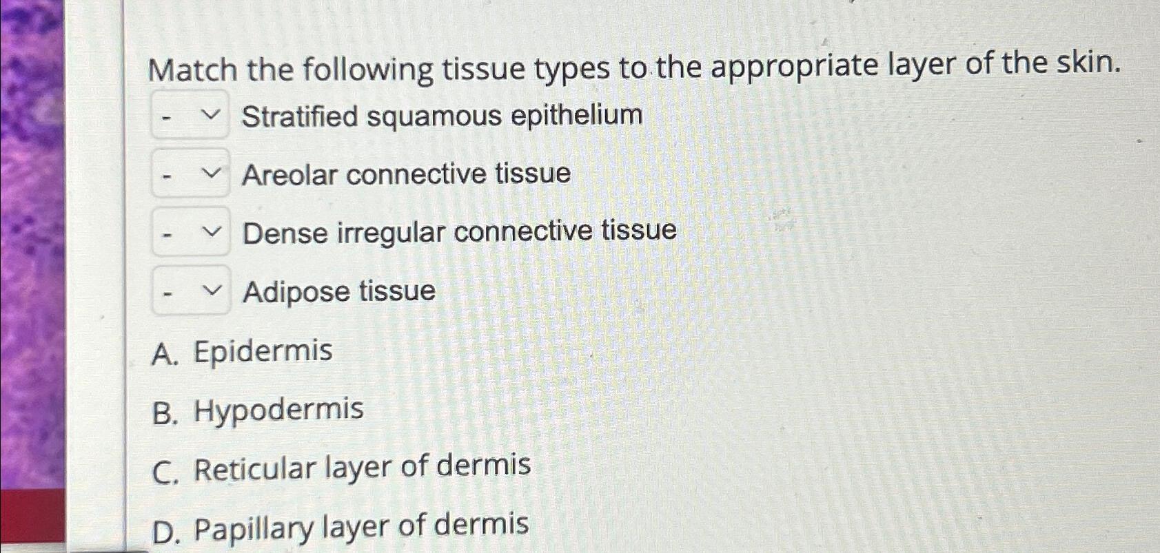 Solved Match the following tissue types to the appropriate | Chegg.com