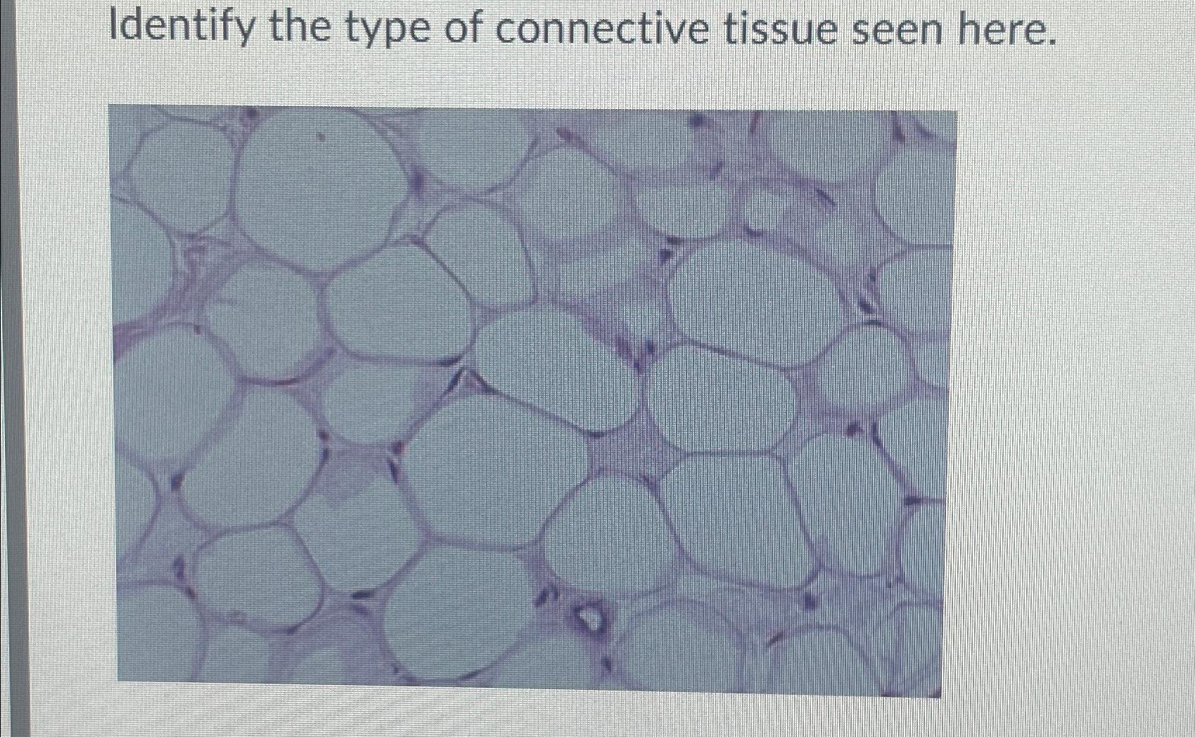 Solved Identify the type of connective tissue seen here. | Chegg.com