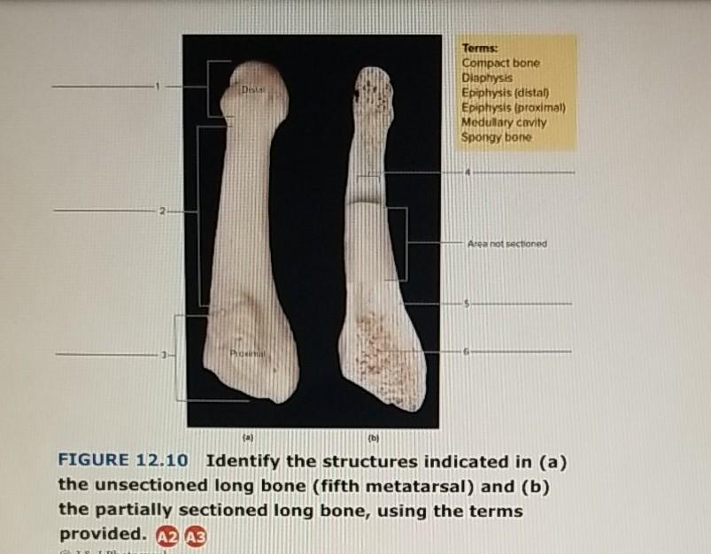 Solved Det Terms: Compact bone Diaphysis Epiphysis (distan) | Chegg.com