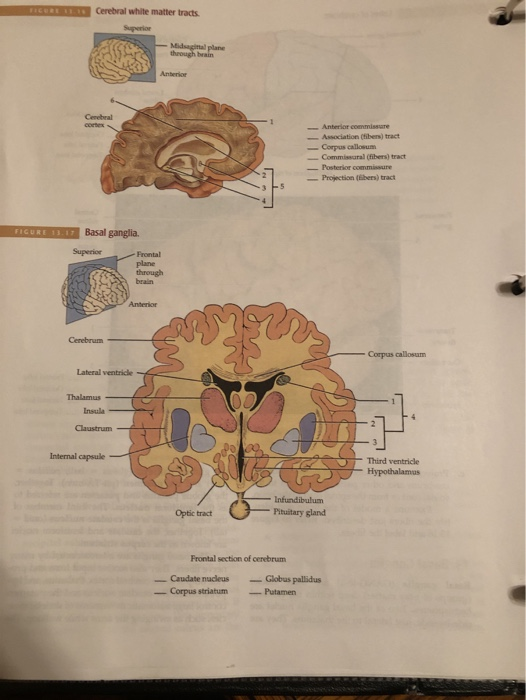 Solved GURE 13.19 Cranial nerves of human brain. (Continued) | Chegg.com Solved GURE 13.19 Cranial nerves of human brain. (Continued) | Chegg.com