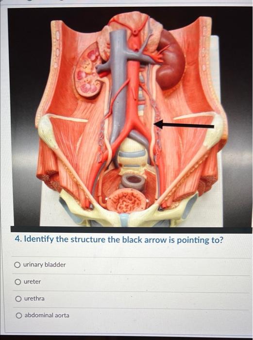 Solved 4. Identify the structure the black arrow is pointing | Chegg.com