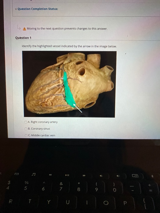 Solved mcphs.blackboard.com asilic vel https://learn- | Chegg.com