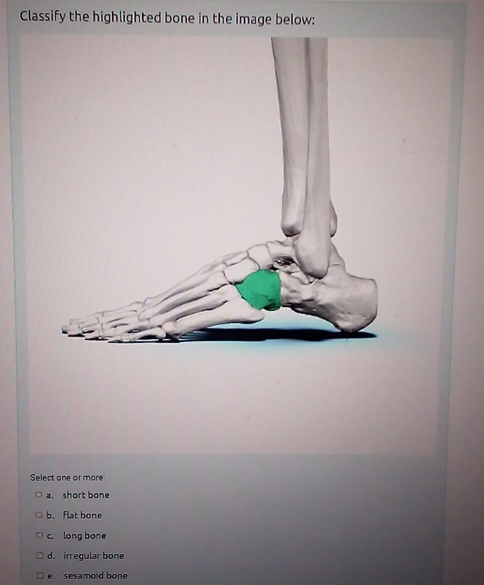 Solved Classify the highlighted bone in the image | Chegg.com
