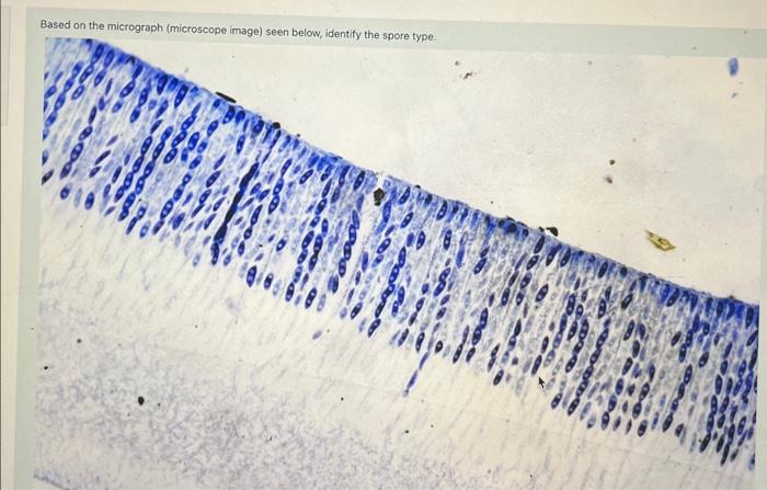Solved Based on the micrograph (microscope image) seen | Chegg.com