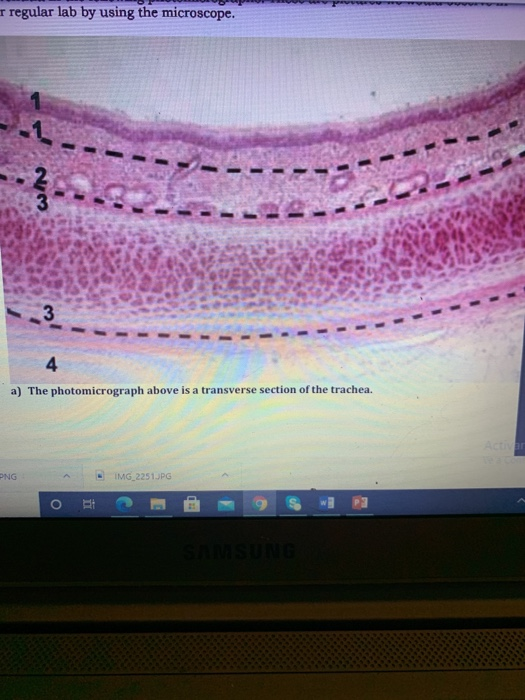 Solved T regular lab by using the microscope. -- 3 4 a) The | Chegg.com