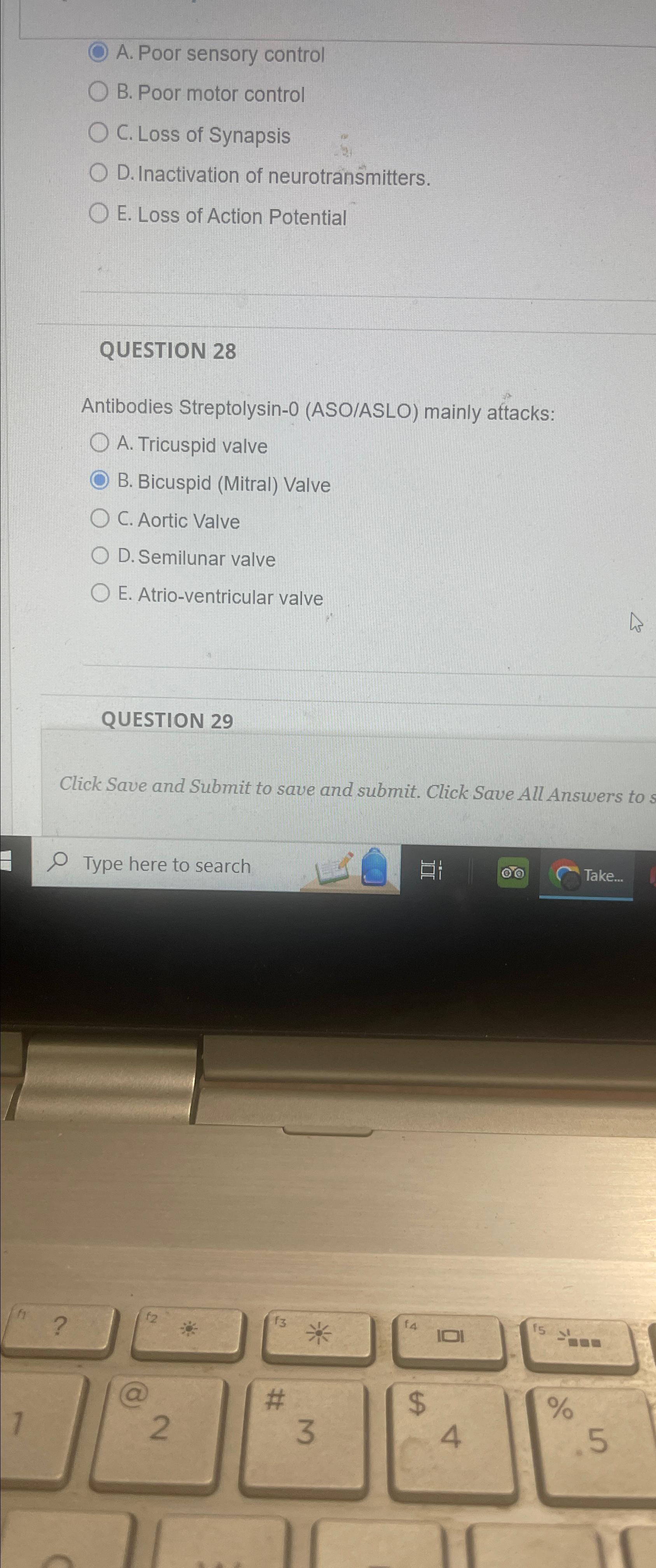 Solved A. ﻿Poor sensory controlB. ﻿Poor motor controlC. | Chegg.com