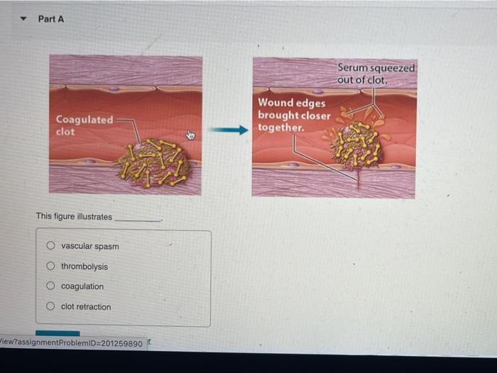Solved Part A Serum squeezed out of clot. Coagulated clot | Chegg.com