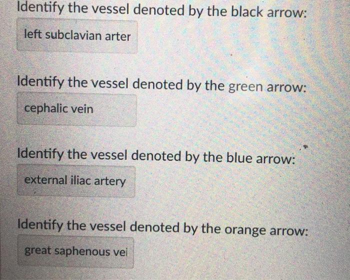 Solved Identify the vessel denoted by the black arrow: | Chegg.com