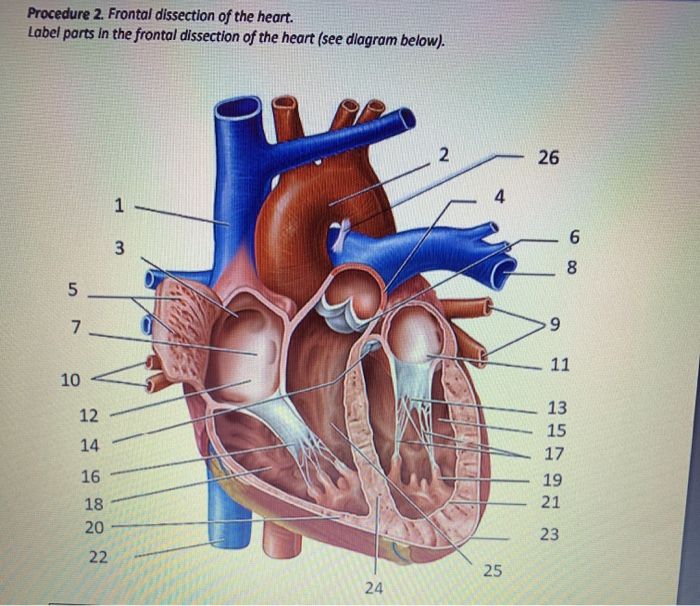 Solved Procedure 2 Frontal Dissection Of The Heart Label Chegg