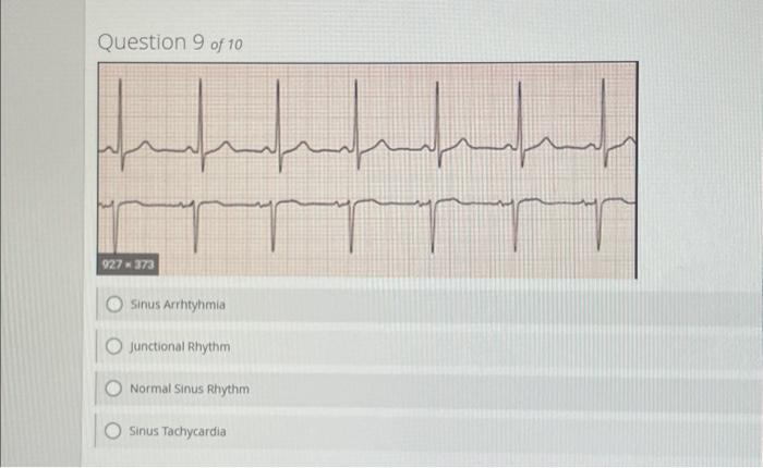 Solved Question 7 of 10 Sinus Bradycardia Junctional | Chegg.com
