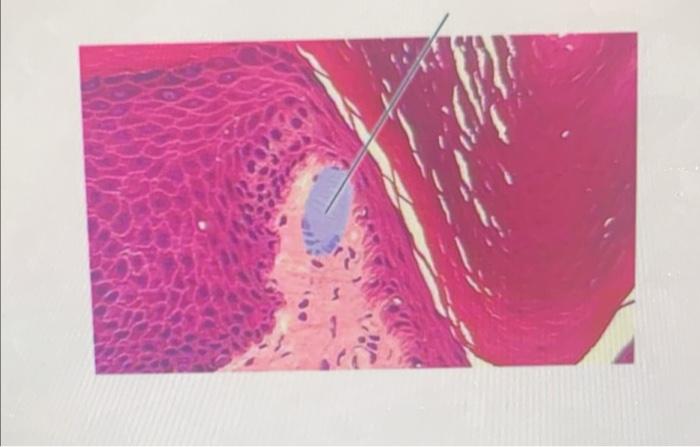 Solved Which structure is highlighted? dermal papilla | Chegg.com