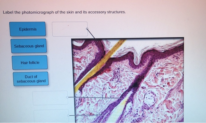 Solved Label the photomicrograph of the skin and its | Chegg.com