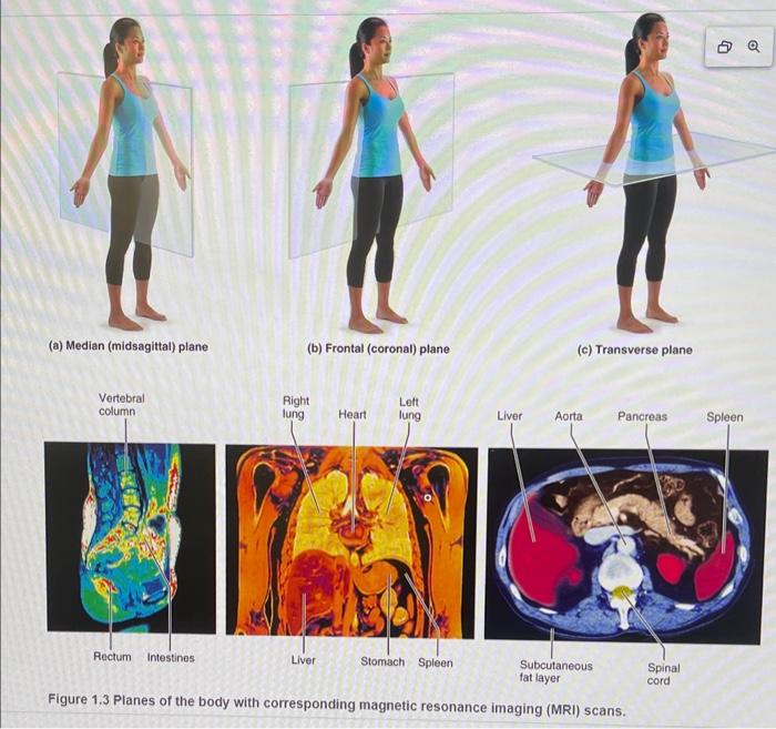 Solved Figure 1.2 Anatomical terminology describing body | Chegg.com