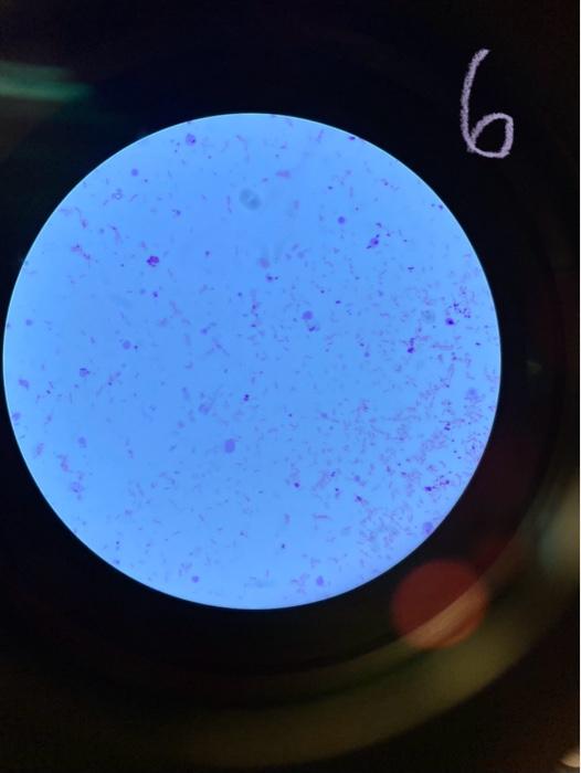 Solved 3. Insert an image of your gram stain smear. Label on | Chegg.com