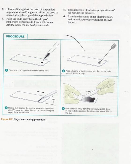 Solved EXPERIMENT Negative Staining 00 8 LEARNING OBJECTIVES | Chegg.com