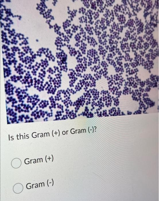 Is this Gram (+) or Gram (-)? Gram (+) Gram (-) | Chegg.com