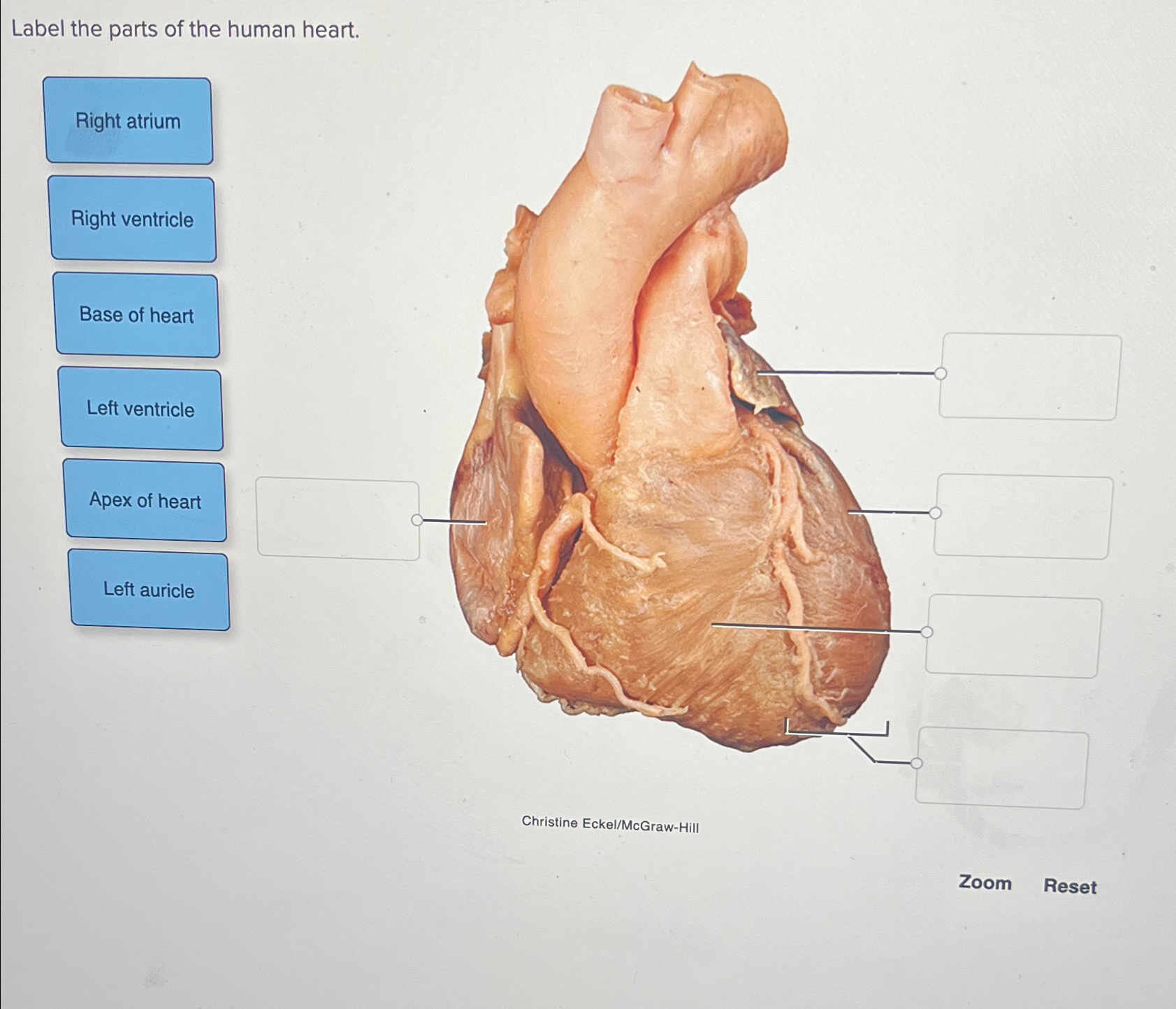 Solved Label the parts of the human heart.ZoomReset | Chegg.com