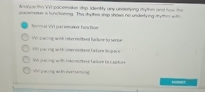 Solved Andivze this VVI pacemaker strip Identity any | Chegg.com