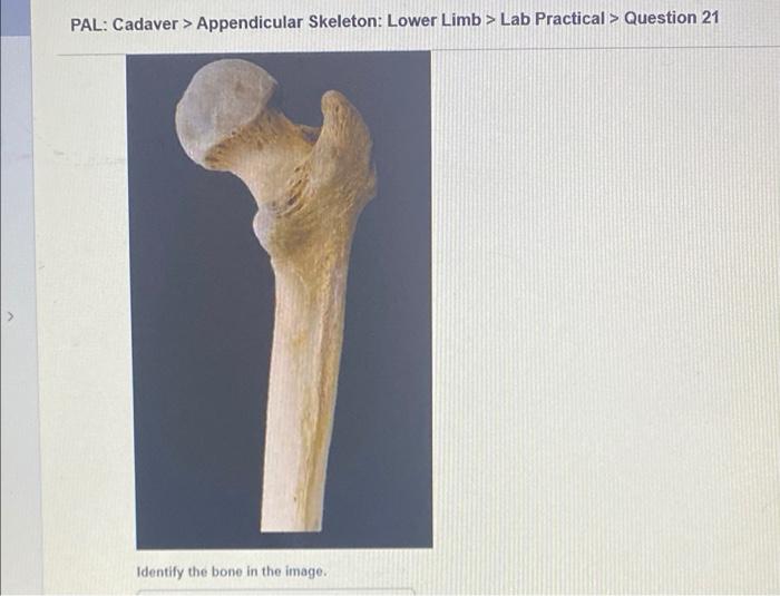 Solved PAL: Cadaver > Appendicular Skeleton: Pelvic Girdle > | Chegg.com