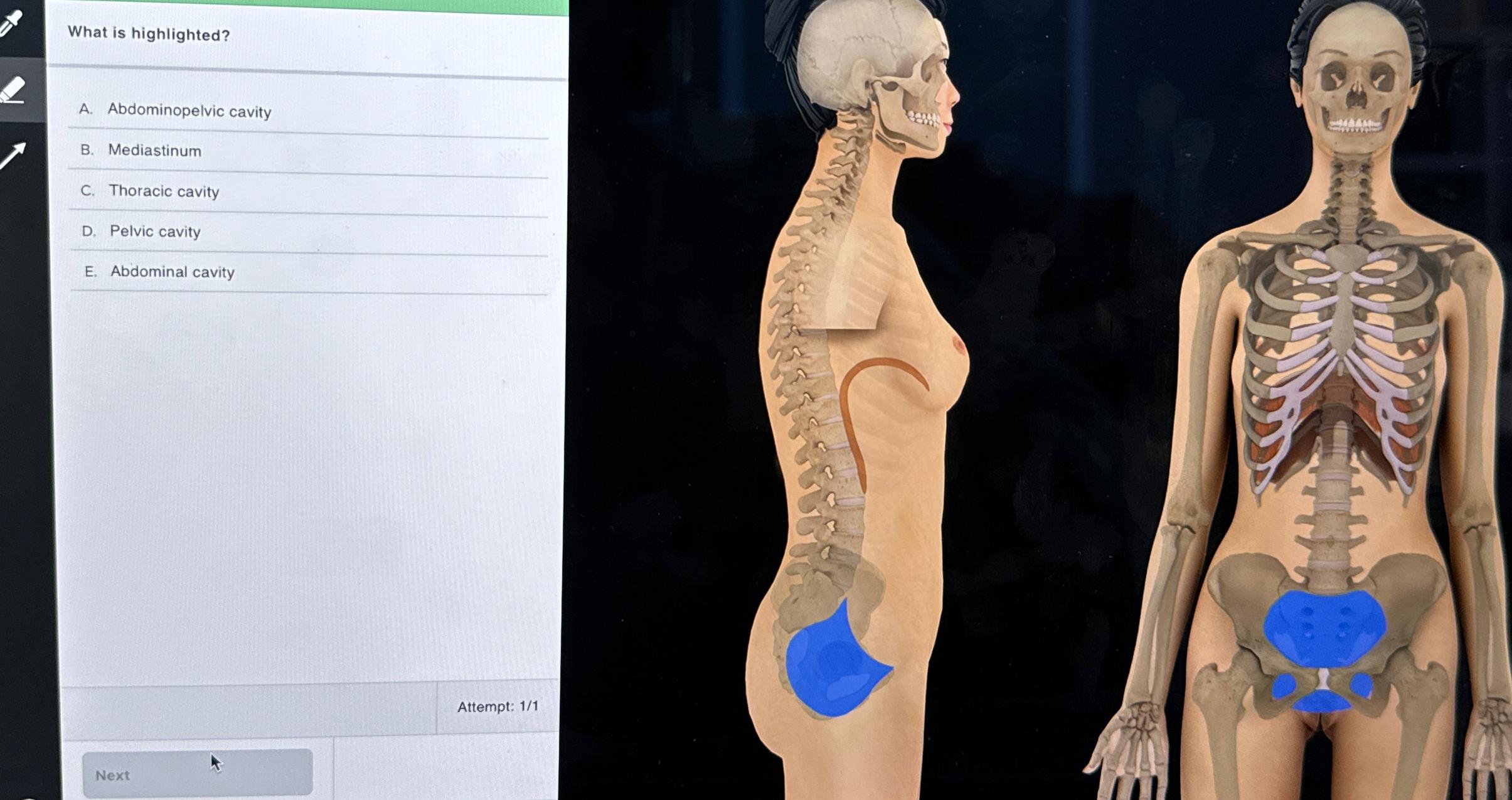 Solved What is highlighted?A. ﻿Abdominopelvic | Chegg.com