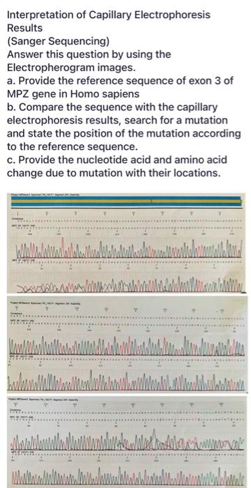 Solved Interpretation of Capillary Electrophoresis Results | Chegg.com