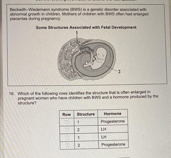 Solved Beckwith-Wiedemann syndrome (BWS) is a genetic | Chegg.com